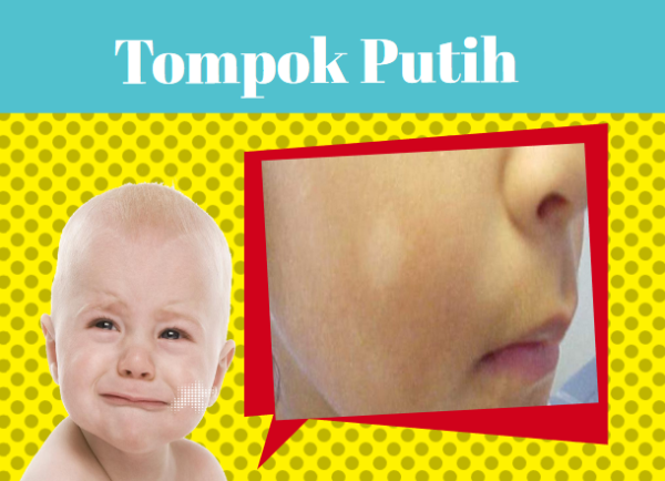 Tompok Putih – National Pharmacy