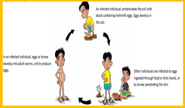 Helminthiasis – National Pharmacy